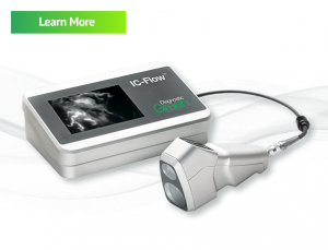 Indocyanine Green ICG Dye use Fluorescence Guided Surgery