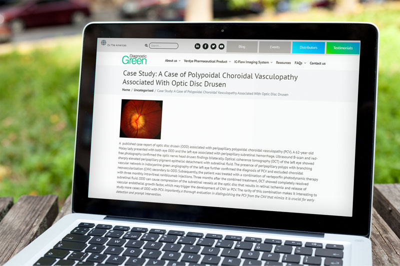Case Study: A Case of Polypoidal Choroidal Vasculopathy Associated With ... Case Study: A Case of Polypoidal Choroidal Vasculopathy Associated With ...