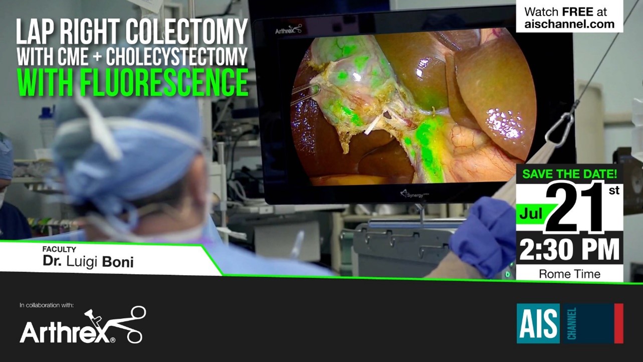 Live Surgery Event on use of ICG in Lap Right Colectomy