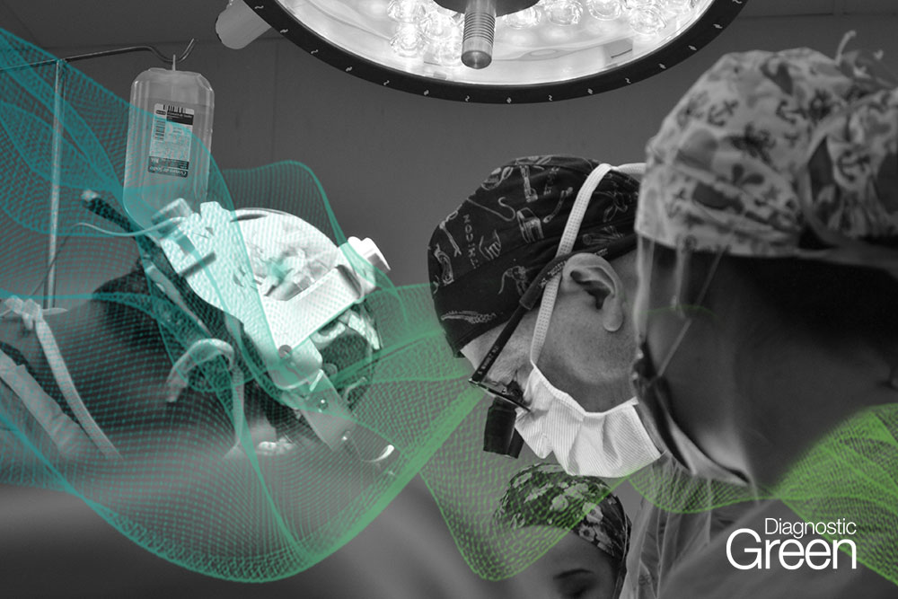 ICG Angiography for Vascular Preservation in Mastectomy