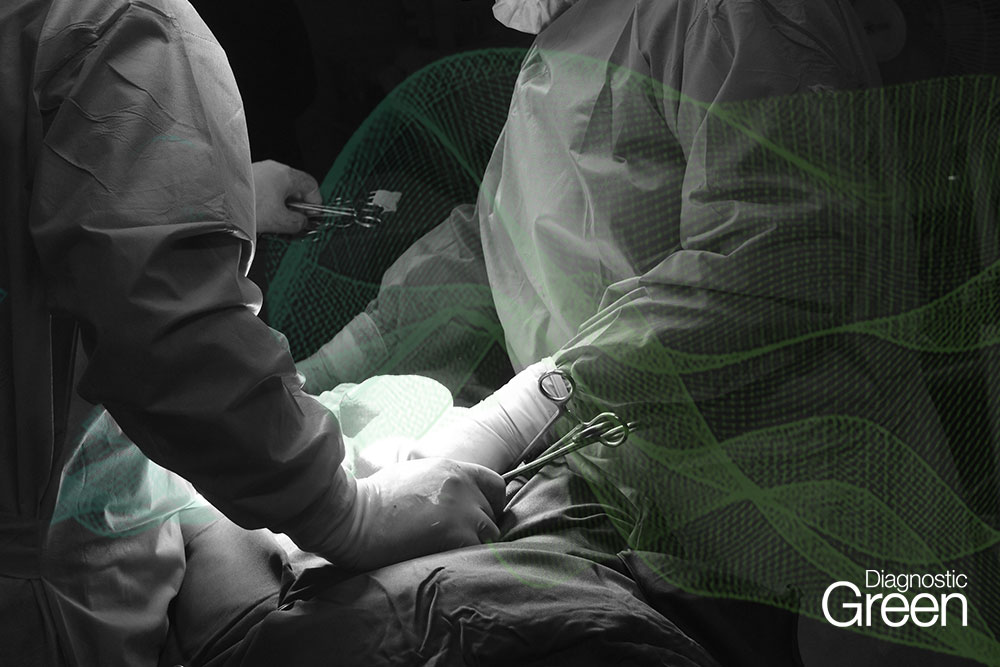 Indocyanine Green in Hepatectomy for Bile Leakage Detection