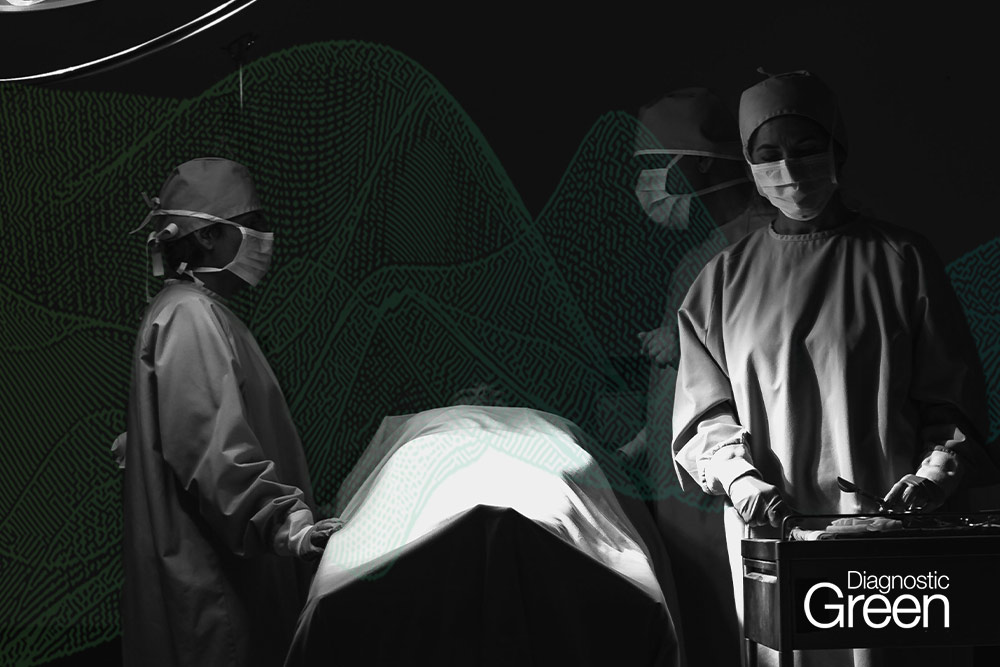 ICGA in Characterizing Vascular Morphology of AMD