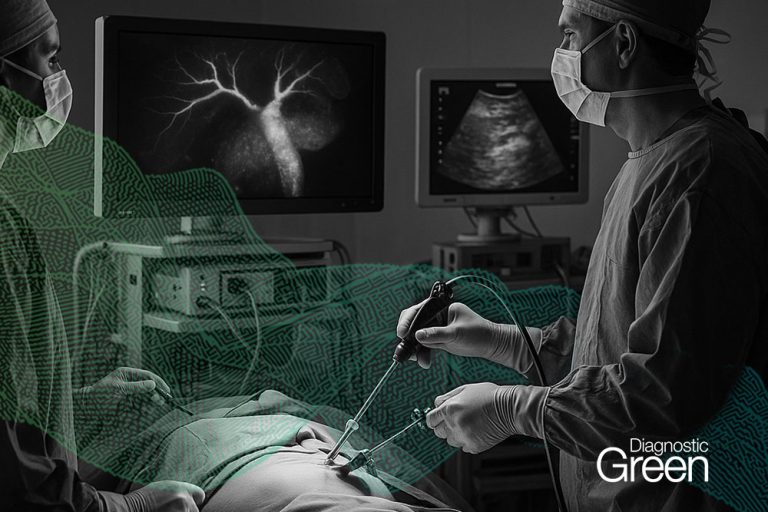 Role of ICG Imaging in Laparoscopic Cholecystectomy